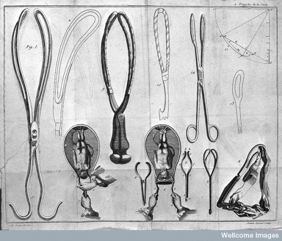 Mystery Instruments: Forceps in Myth and History - Dittrick Medical ...