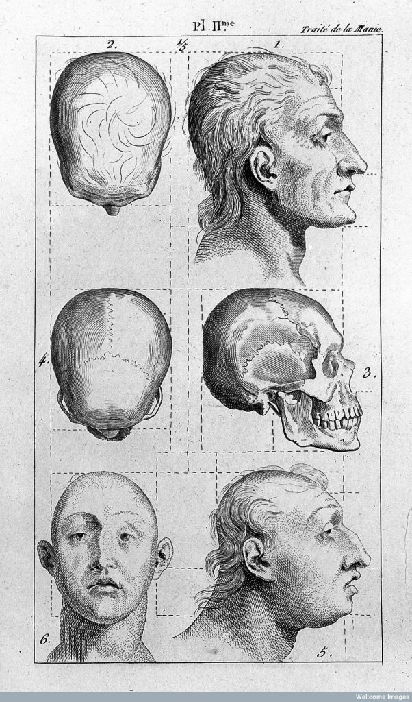 L0016100 Six pictures of crania and heads of the insane. - Dittrick ...