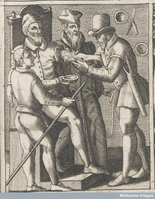 The Spring-Lancet, A “Bloodstain’d Faithful Friend!” - Dittrick Medical ...