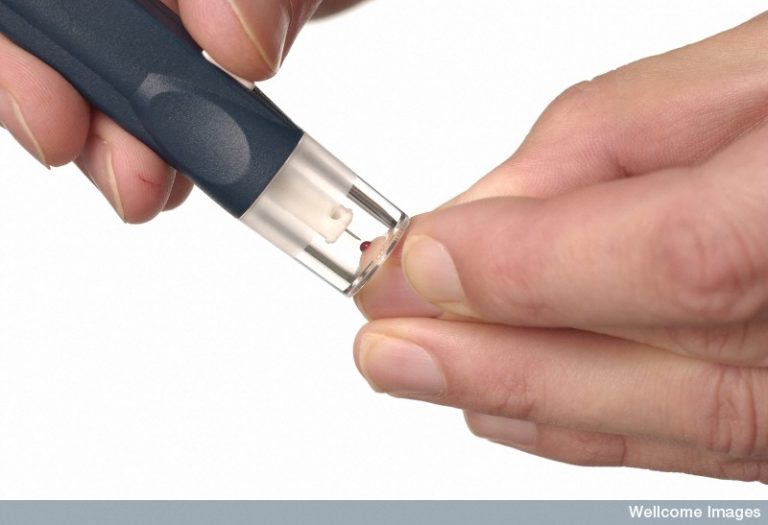 N0029189 Pinprick device used in blood tests - Dittrick Medical History ...